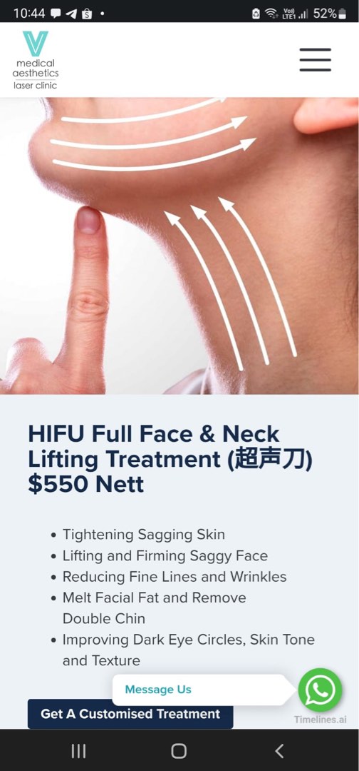 HIFU Treatment at V Medical Aesthetics, Beauty & Personal Care, Face ...