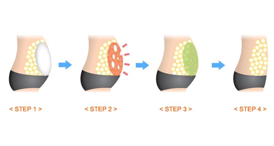 Lipolab meso slimming, Beauty & Personal Care, Bath & Body, Body Care ...