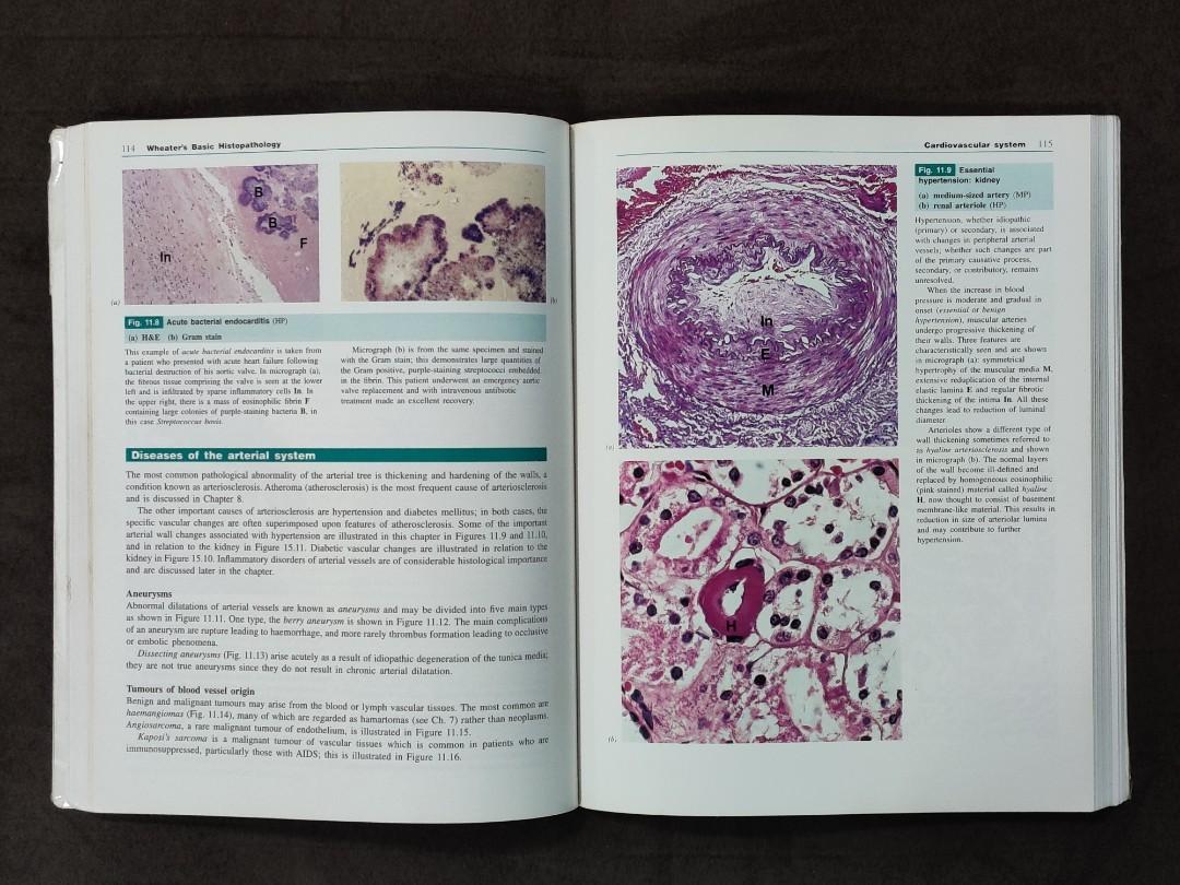 Wheater's Basic Histopathology 3rd Ed, Hobbies & Toys, Books ...