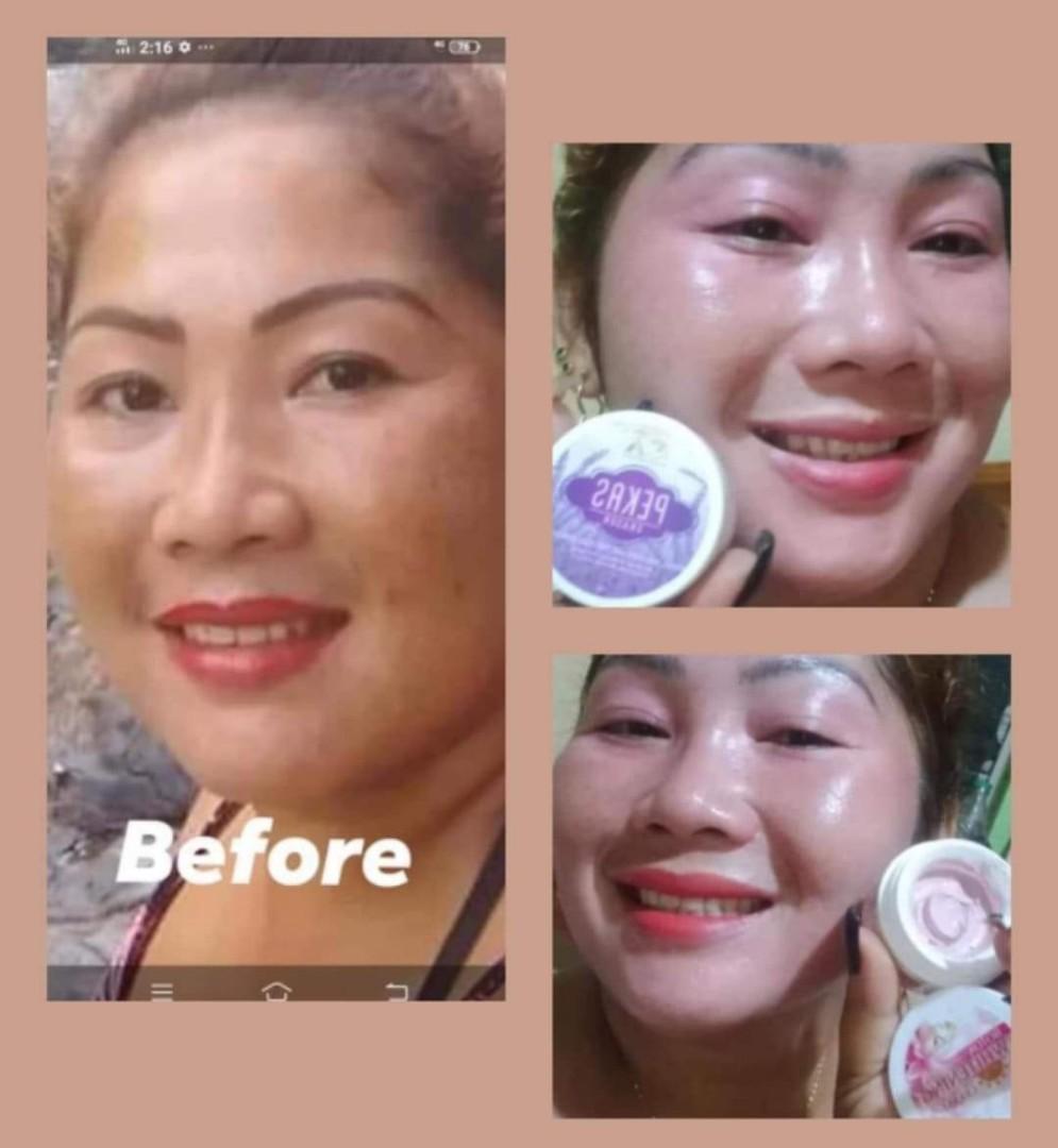 Pekas Eraser Cream by Capadosa, Beauty & Personal Care, Face, Face Care ...