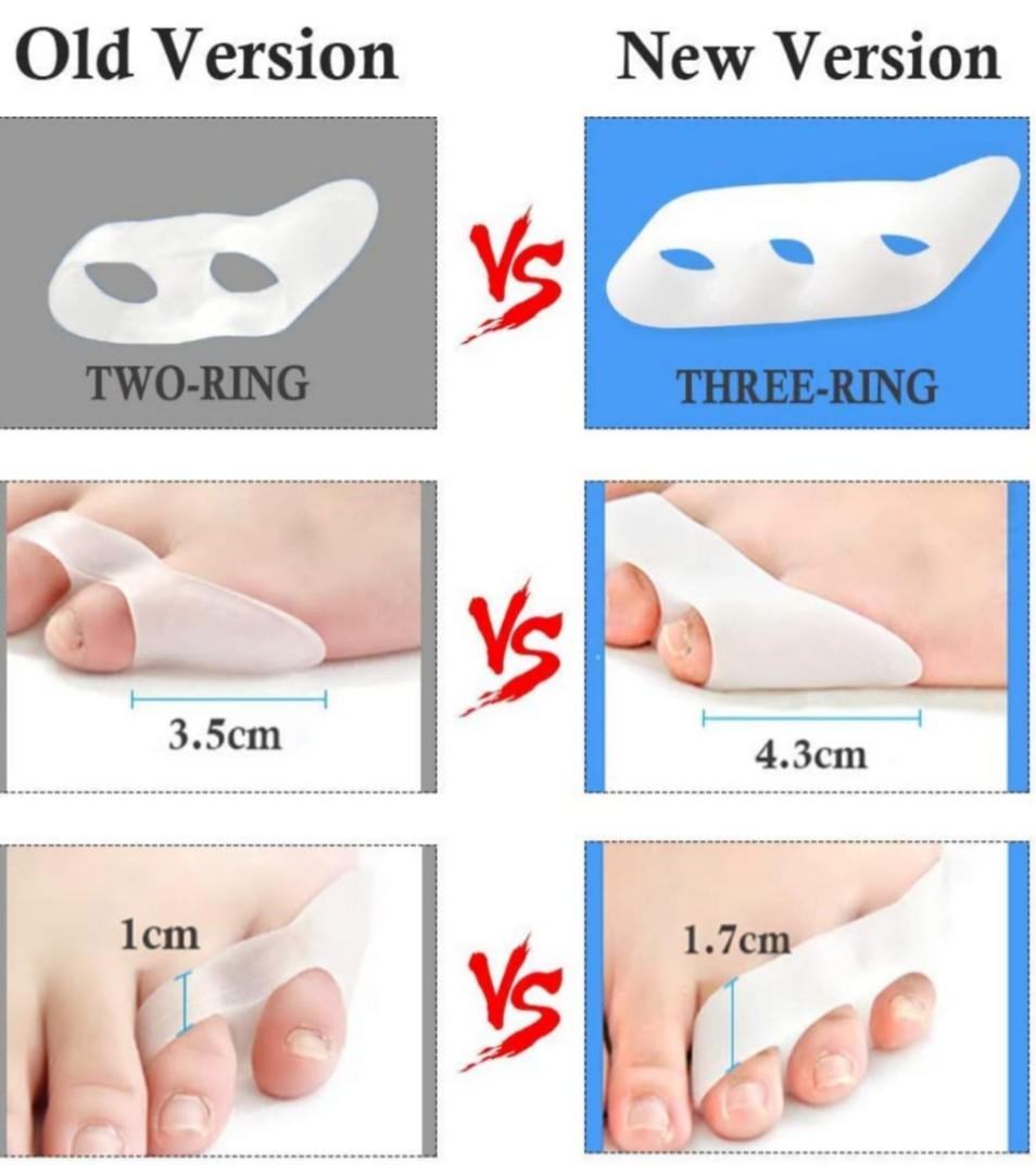 Prevent Overlapping Toe, Blister and Corn, Beauty & Personal Care, Foot ...