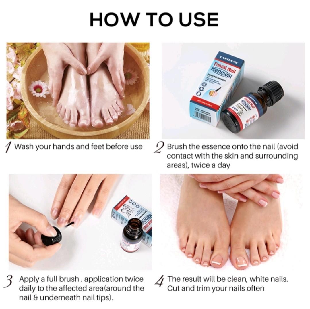 Lanthome Herbal Fungal Nail Renewal, Beauty & Personal Care, Hands ...