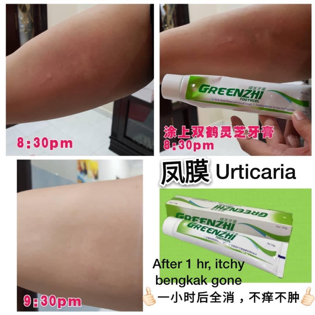 Greenzhi Toothgel (Lingzhi), Beauty & Personal Care, Oral Care on Carousell