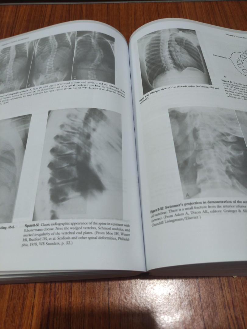 Orthopedic Physical Assessment by Magee 6th Ed, Hobbies & Toys, Books ...