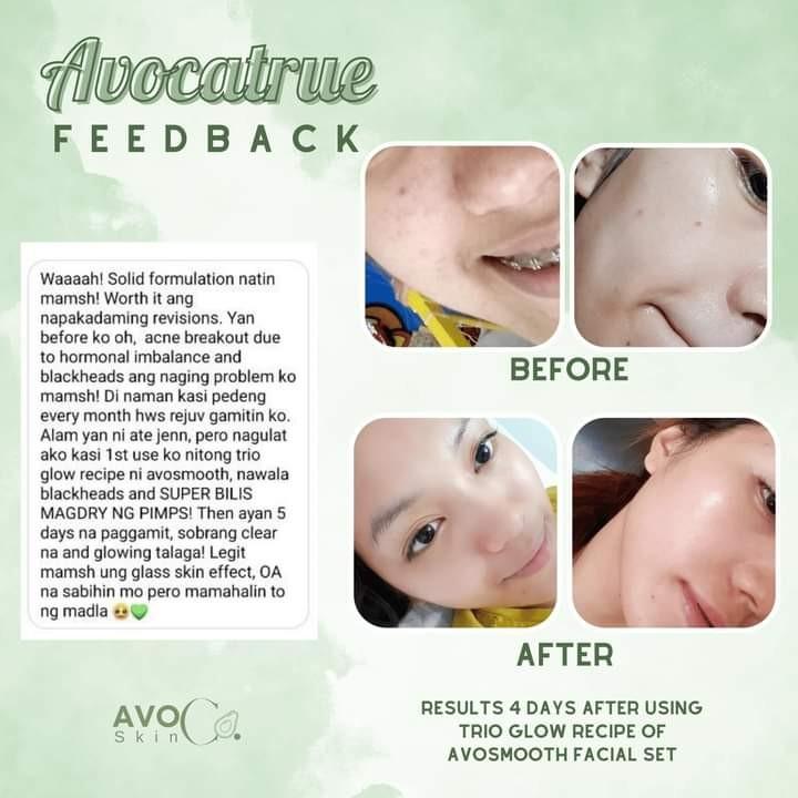 Avo Skin Co. Avo Smooth Facial Set - Gentle Foaming Wash , Glow Toner , Dewy Serum, Beauty ...