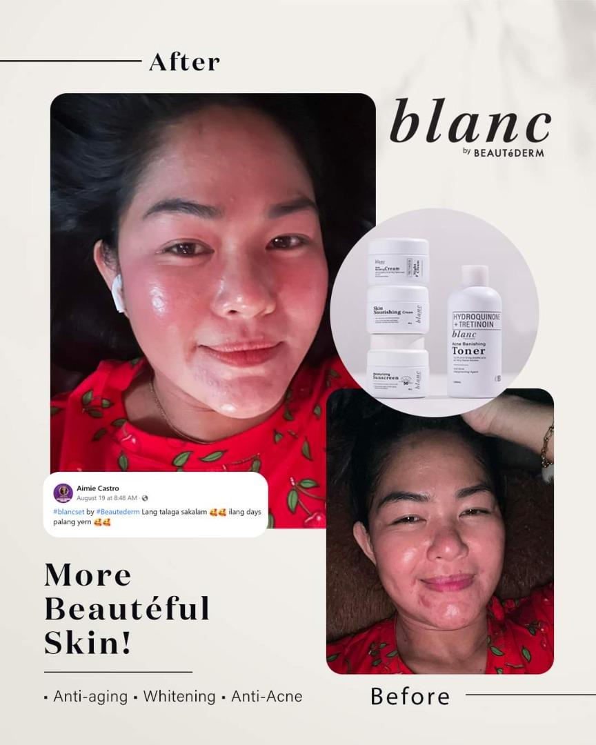 Beautederm Blanc Skin Nourishing Cream 20g, Beauty & Personal Care ...