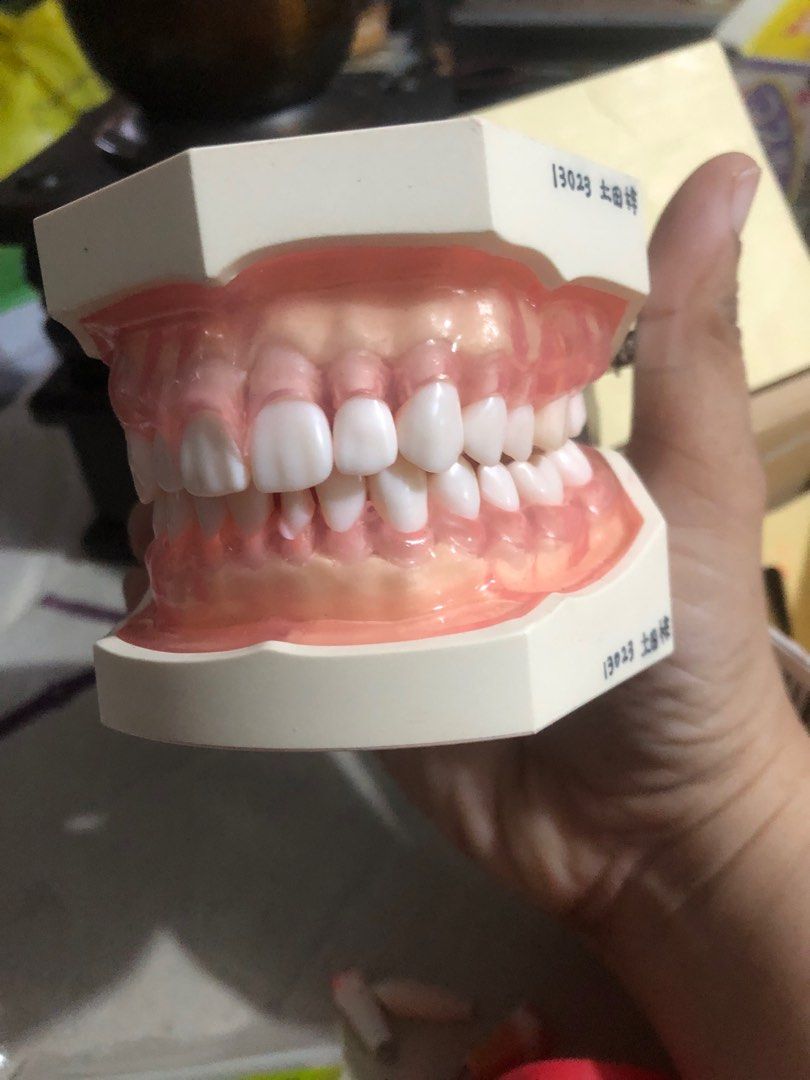 Dental model - Japan Surplus original, Health & Nutrition, Medical ...
