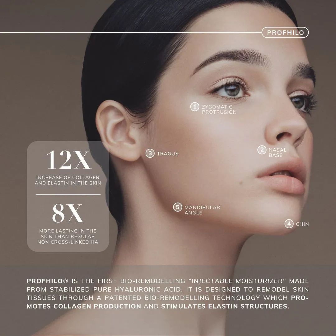 PROFHILO Full Treatment 2 Sessions $577/-, Beauty & Personal Care, Face ...