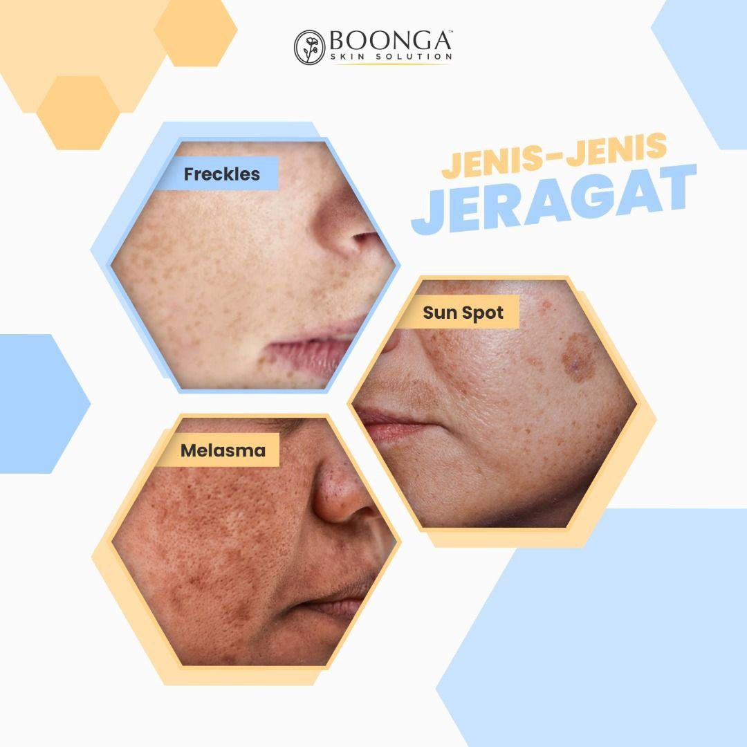 Boonga repairing cream, Beauty & Personal Care, Face, Face Care on ...