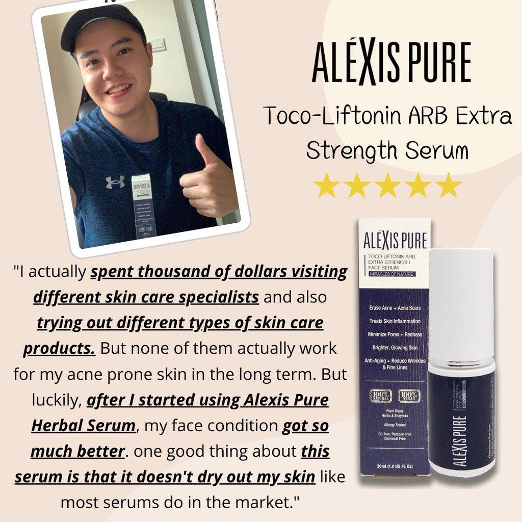 Alexis Pure Toco-Liftonin ARB Serum: 100% Natural Herbal Face Serum: ERASE ACNE, PIMPLE & CYSTS ...