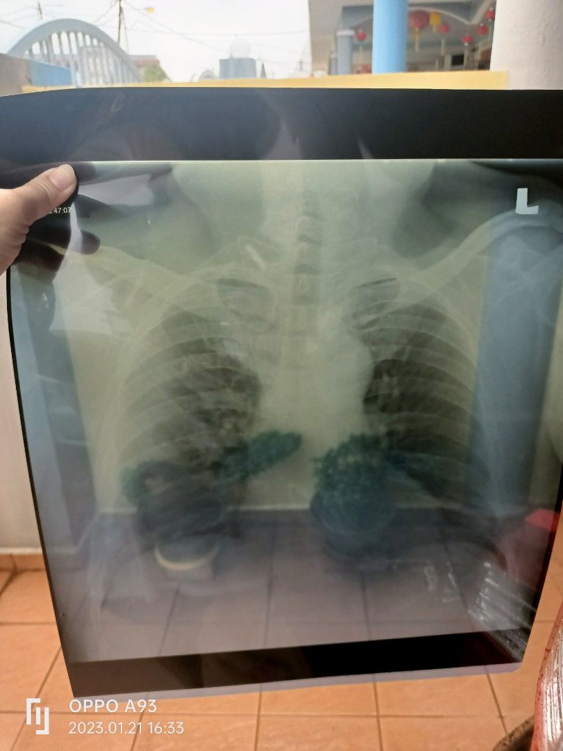 X ray & computer x ray, Everything Else, Others on Carousell