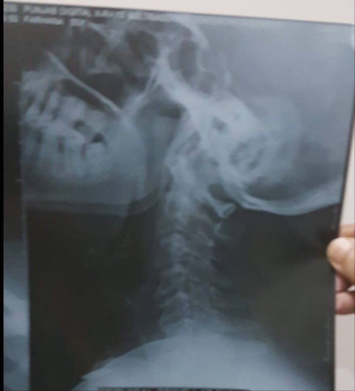 X ray & computer x ray, Everything Else, Others on Carousell