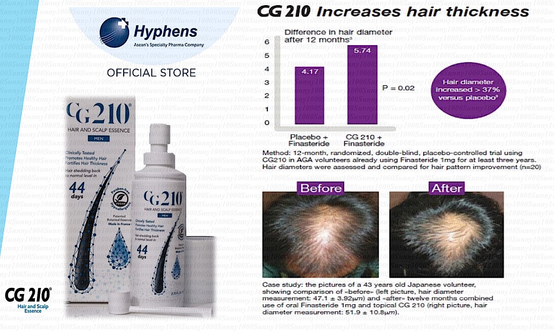 Hyphens Pharma CG210 Hair and Scalp Essence 80ml (Men/Mint); Expiration ...