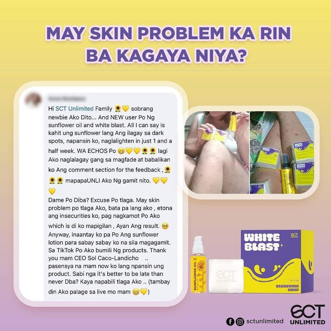 Sunflower Oil and White Blast Bleaching Soap, Beauty & Personal Care, Bath & Body, Body Care on ...