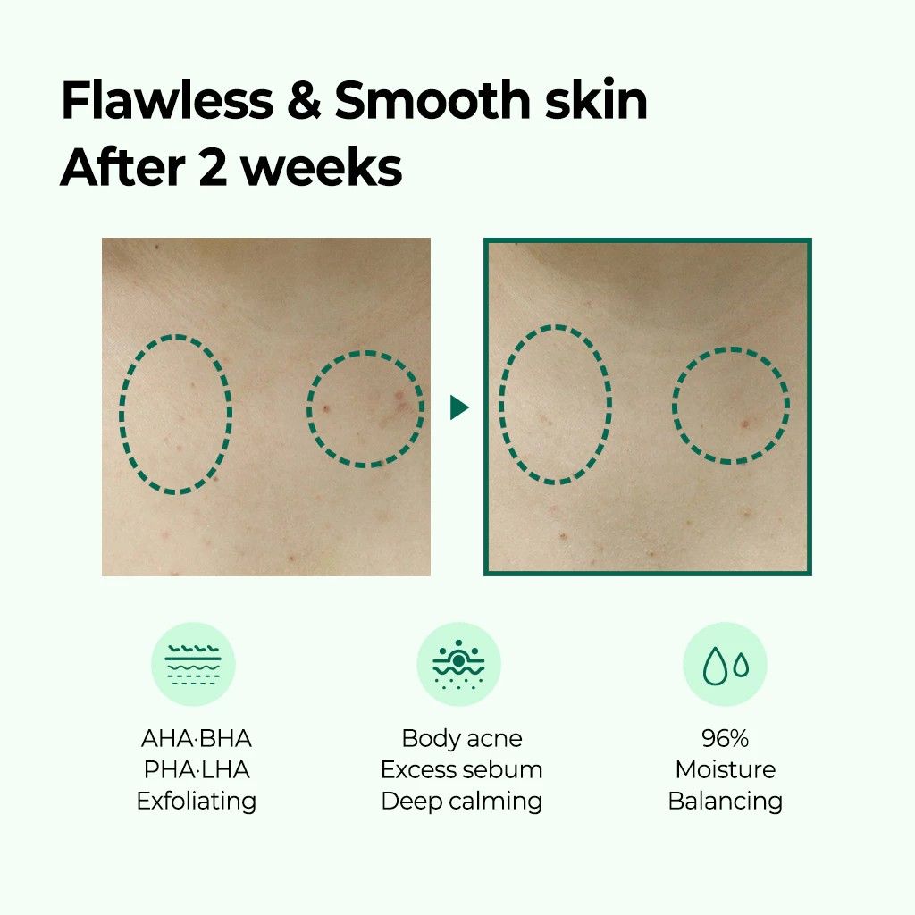 [Some by Mi] Miracle Calming body lotion, Beauty & Personal Care, Bath ...