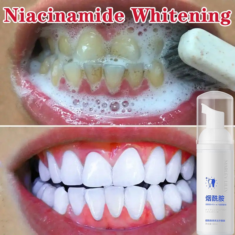 Tooth Mousse Tooth Whitening Oral Hygiene Toothpaste Remove Stains ...