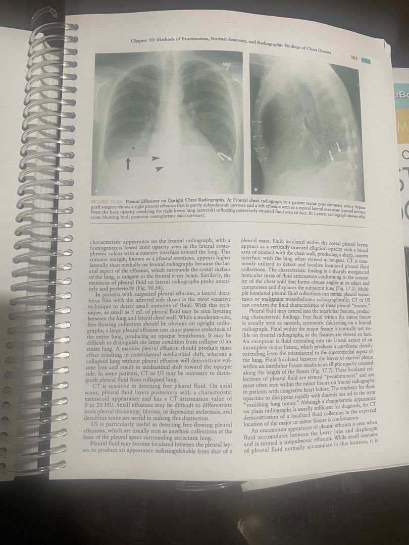 Brant and Helms - Fundamentals of Diagnostic Radiology 5th ed, Hobbies ...