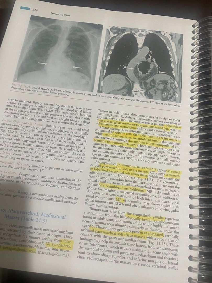 Brant and Helms - Fundamentals of Diagnostic Radiology 5th ed, Hobbies ...