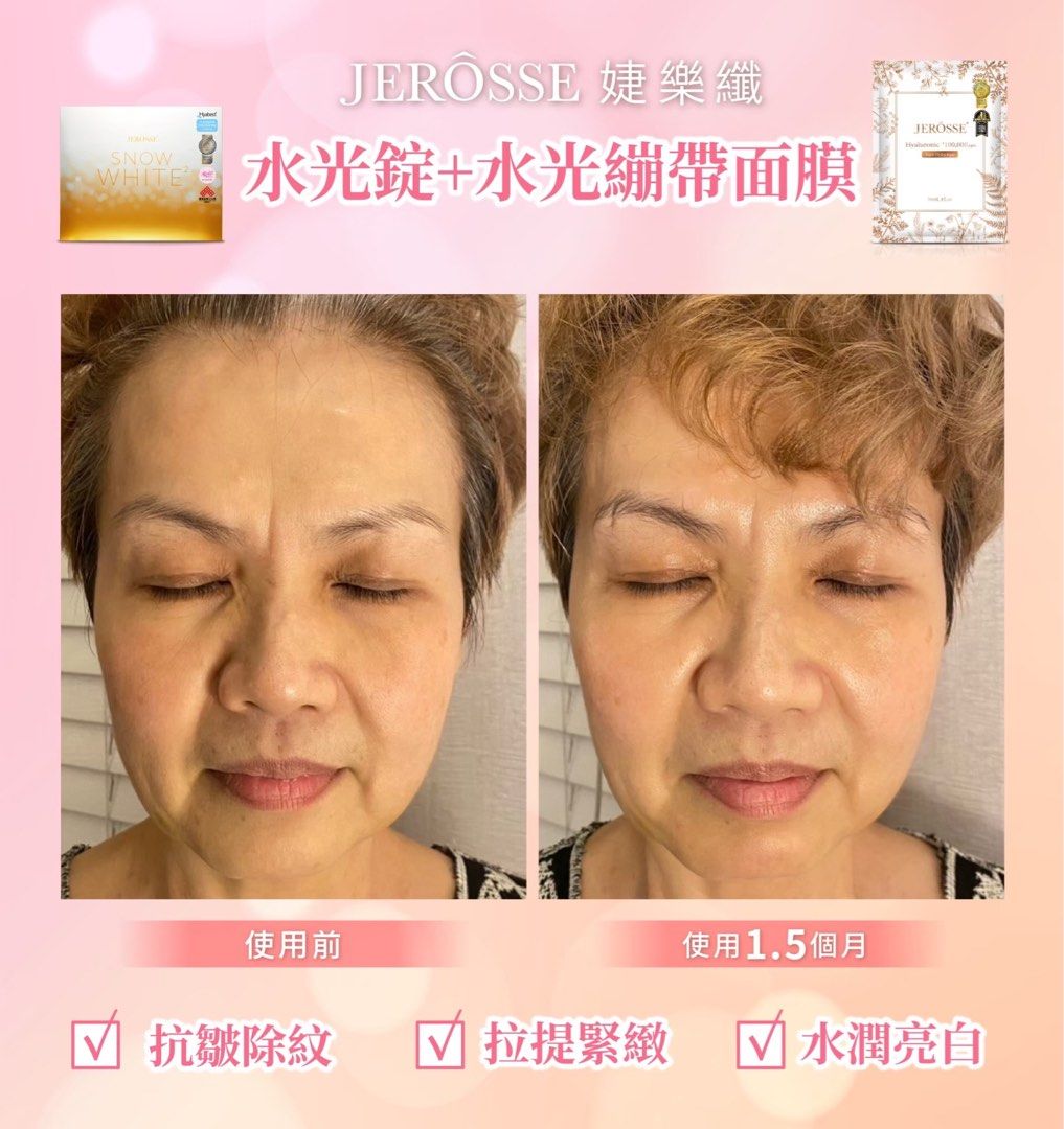 Snow White improves skin from inside out, Health & Nutrition, Health ...