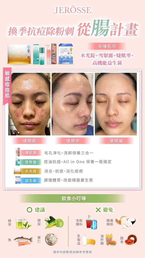 Snow White improves skin from inside out, Health & Nutrition, Health ...