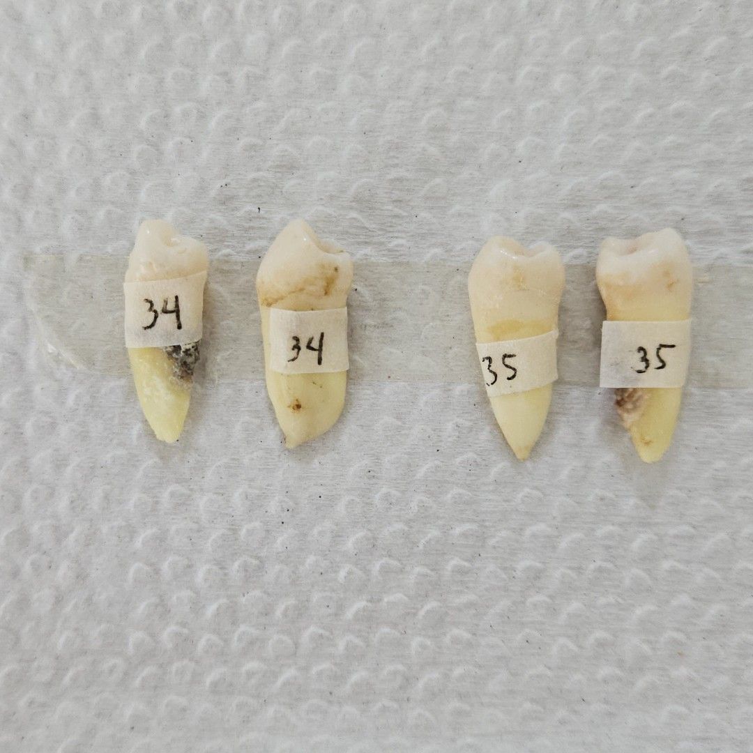 Natural Tooth for Resto, Endo, Everything Else, Others on Carousell