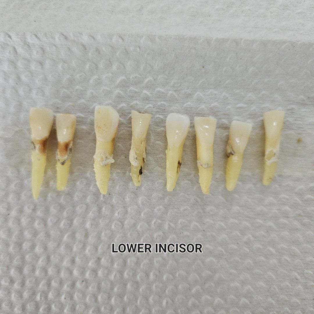 Natural Tooth for Resto, Endo, Everything Else, Others on Carousell