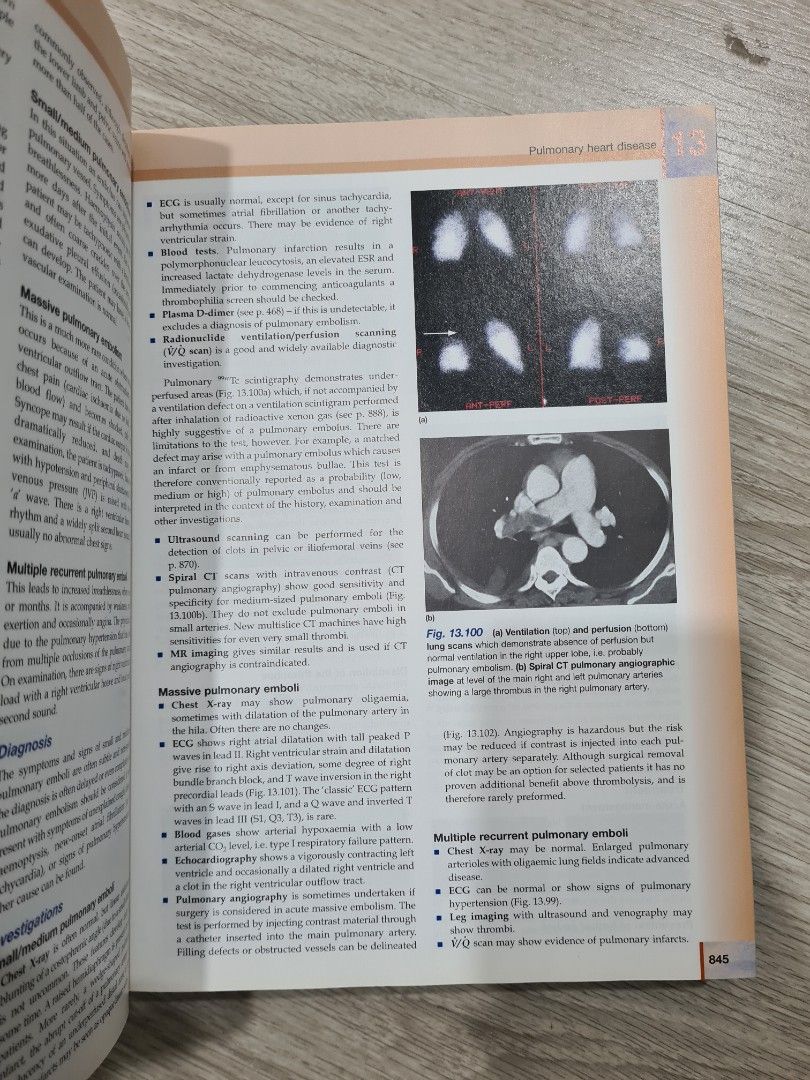 Kumar & Clark Clinical Medicine 6th Edition, Hobbies & Toys, Books & Magazines, Textbooks on ...