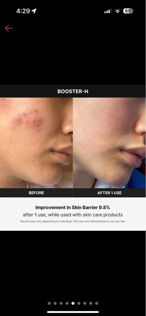 Medicube AGE-R Booster Healer/ H, Beauty & Personal Care, Face, Face ...