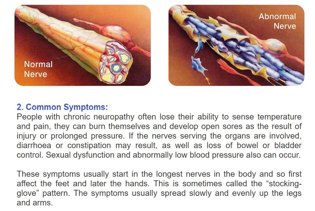 bionerv (alpha lipoic acid+ vitamin b1, b6, b12) to strengthen nerve ...