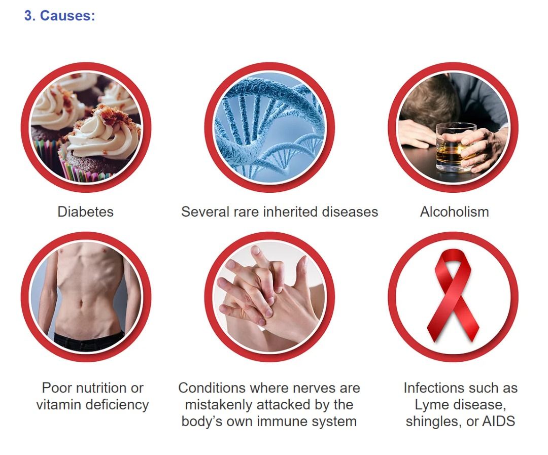 bionerv (alpha lipoic acid+ vitamin b1, b6, b12) to strengthen nerve ...