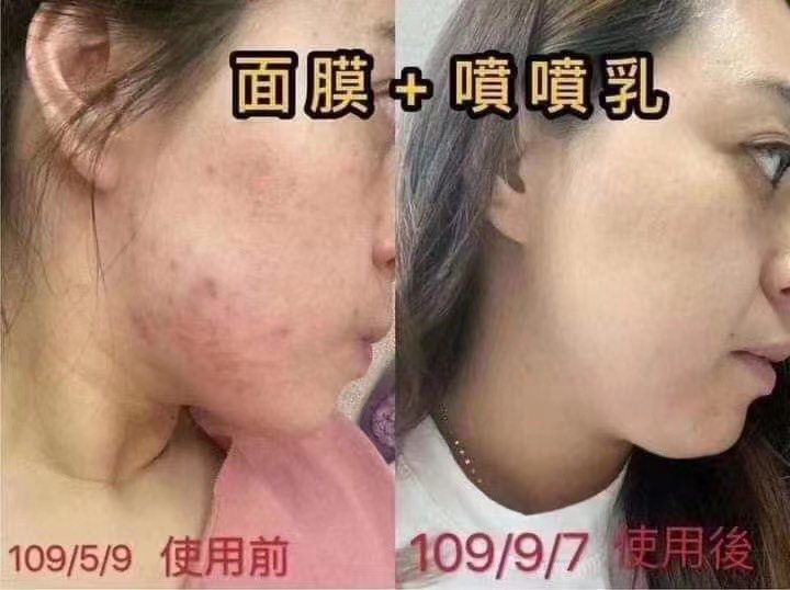 Legend Age Emulsion Spray, Beauty & Personal Care, Face, Face Care on ...