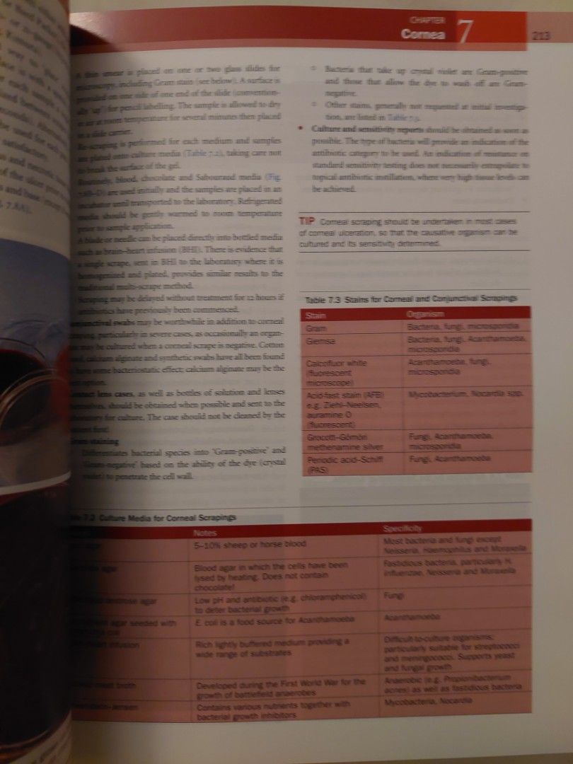 Kanski's Clinical Ophthalmology, 9th Ed, Hobbies & Toys, Books ...