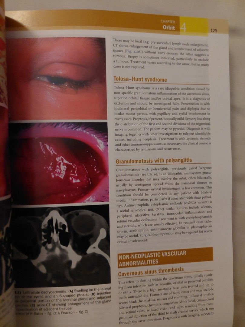 Kanski's Clinical Ophthalmology, 9th Ed, Hobbies & Toys, Books ...
