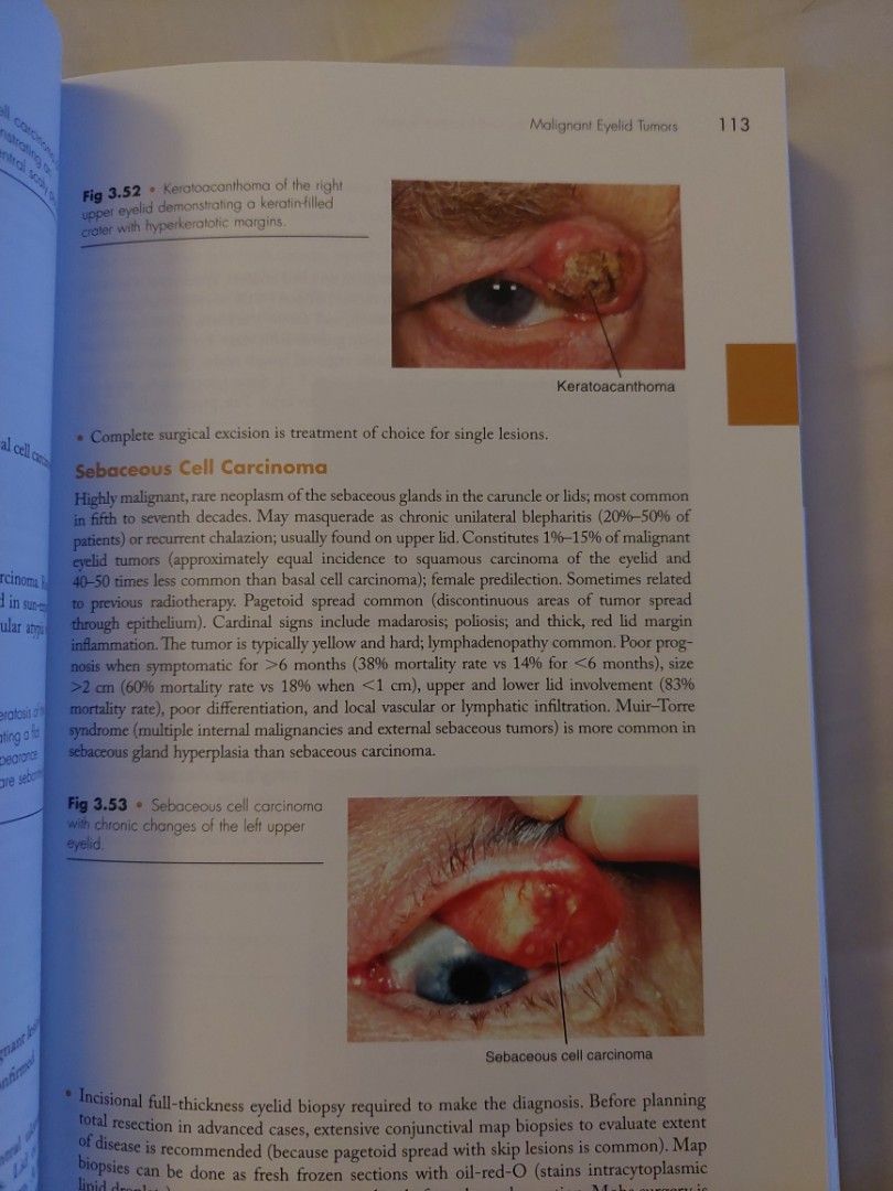 Massachusetts eye and ear infirmary illustrated manual of Ophthalmology ...