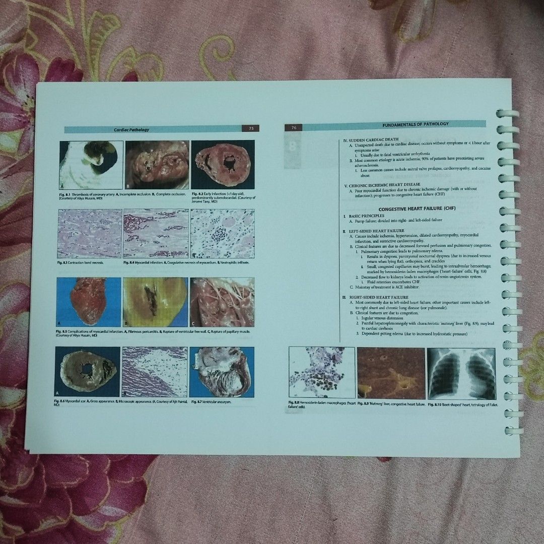 Pathoma Fundamentals of Patho PLE, Hobbies & Toys, Books & Magazines ...