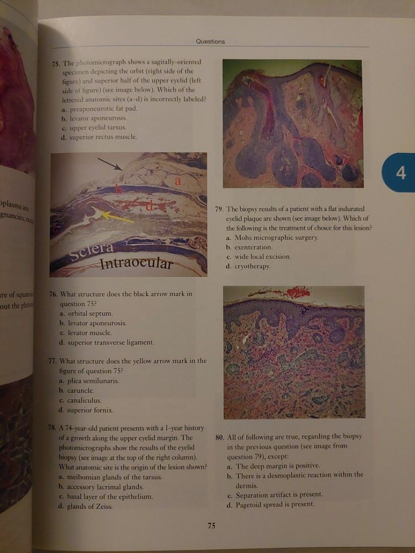 Review manual for Ophthalmology, Hobbies & Toys, Books & Magazines ...