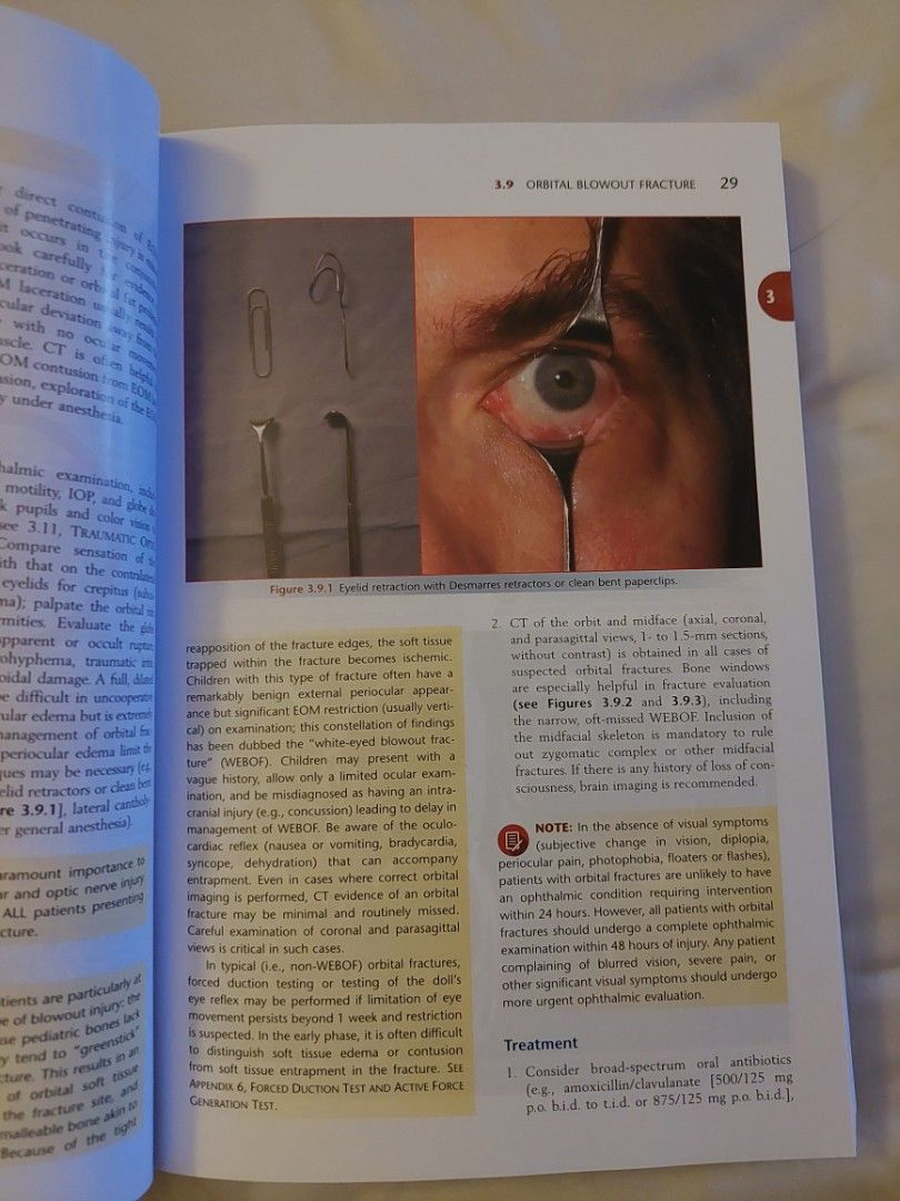 Wills eye manual (ophthalmology), Hobbies & Toys, Books & Magazines ...