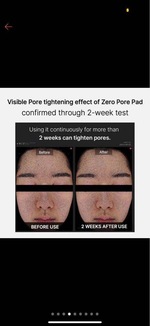 Medicine Zero Pad 2.0, Beauty & Personal Care, Face, Face Care on Carousell