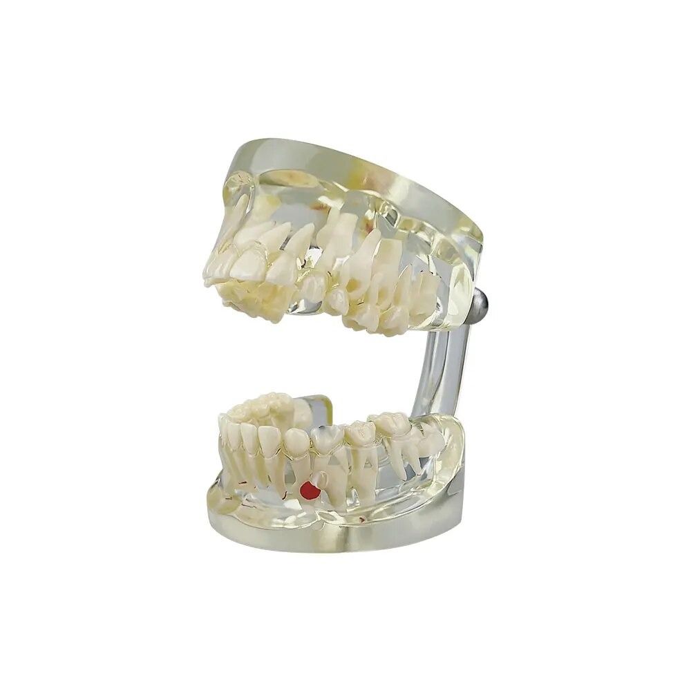 Dental Teaching Model Child Primary Teeth Mixed Dentition Model With ...