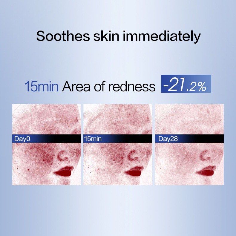 Proya Advanced Original Repair Concentrating Mask, Beauty & Personal ...