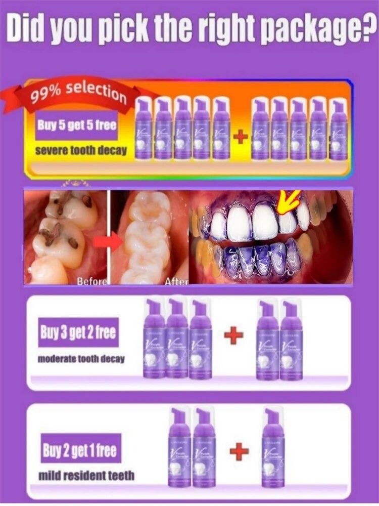 Tooth Decay Repair Foam Mousse Quick Repair of Cavities Caries Protect ...