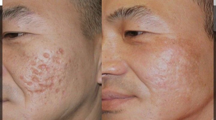 Scar Rejuvenation, Lifestyle Services, Beauty & Health Services on ...