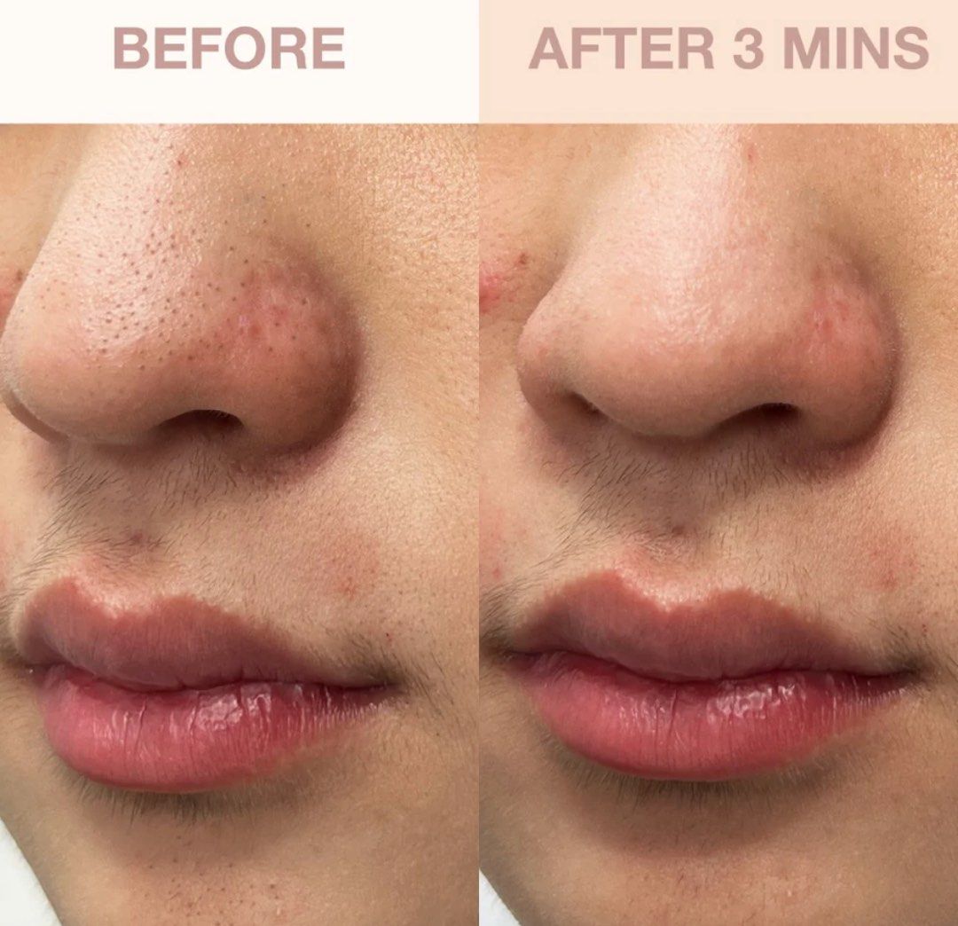 Skin inc Deepcare O2 Hydro-Facial Pore Refiner Device, Beauty ...