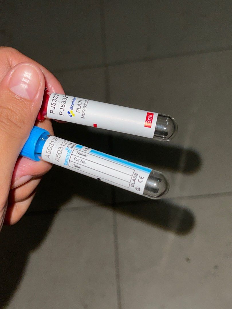 EVACUATED TUBES (expired), Health & Nutrition, Medical Supplies & Tools ...