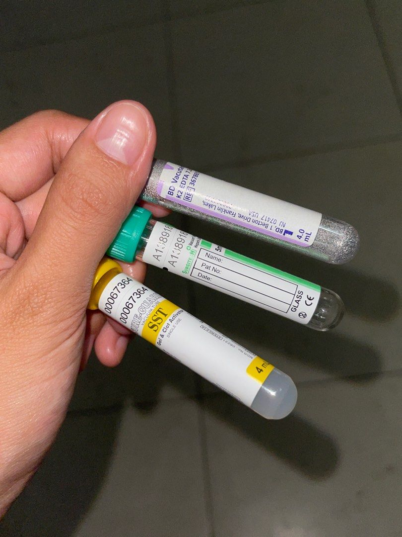 EVACUATED TUBES (expired), Health & Nutrition, Medical Supplies & Tools ...