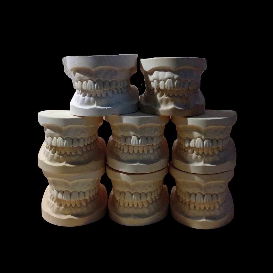 Dentulous Cast, Health & Nutrition, Medical Supplies & Tools on Carousell
