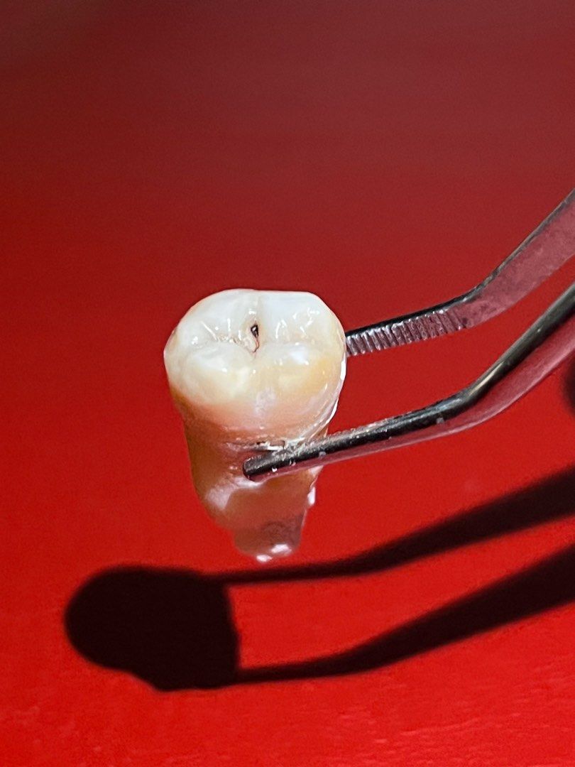 Molars Natural Teeth, Health & Nutrition, Medical Supplies & Tools on ...