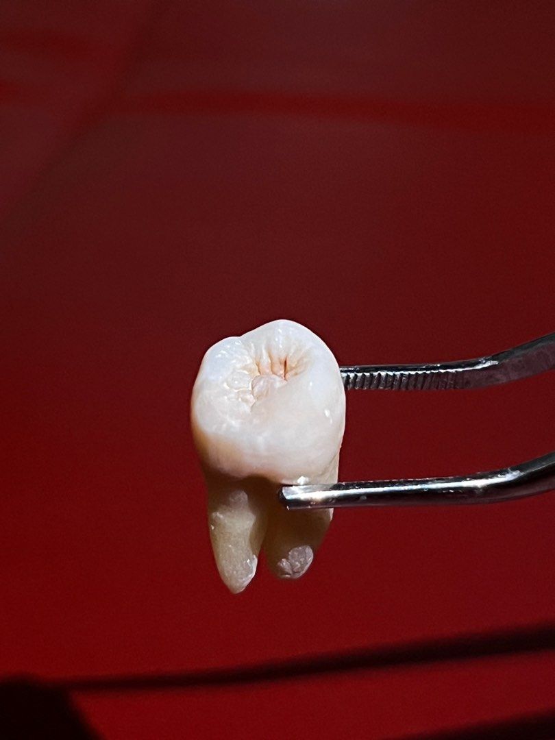 Molars Natural Teeth, Health & Nutrition, Medical Supplies & Tools on ...