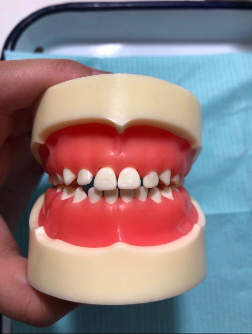 Pedia jaw, Health & Nutrition, Medical Supplies & Tools on Carousell