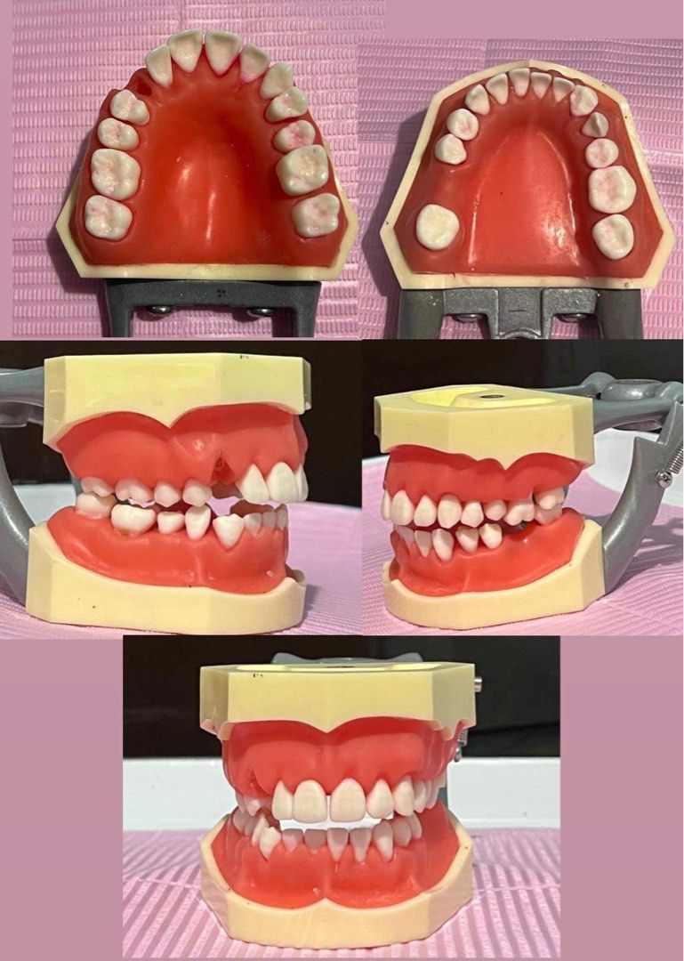 Perio jaw, Beauty & Personal Care, Oral Care on Carousell